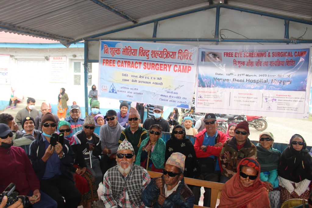 निशूल्क आँखा शिविरमा ८२ जनाको मोतियाबिन्दुको शल्यक्रिया – धौलागिरी खबर